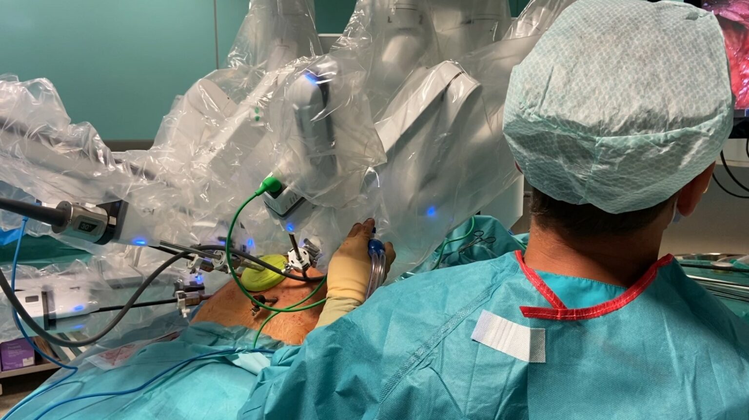 Tak wygląda operacja z pomocą robota da Vinci